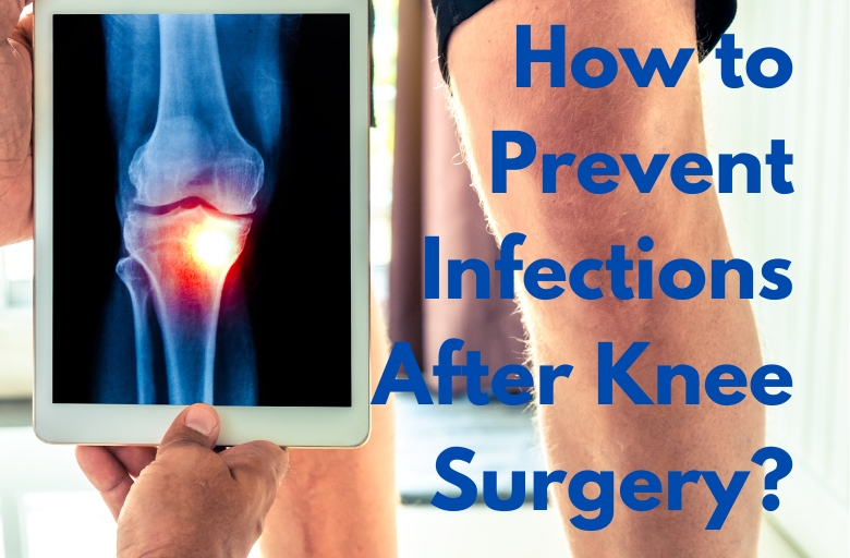 How to Prevent Infections After Knee Surgery? - Primespecialityclinic